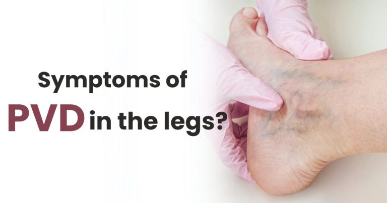 Peripheral Vascular Disease Leg Symptoms | Dr. Harish Badami